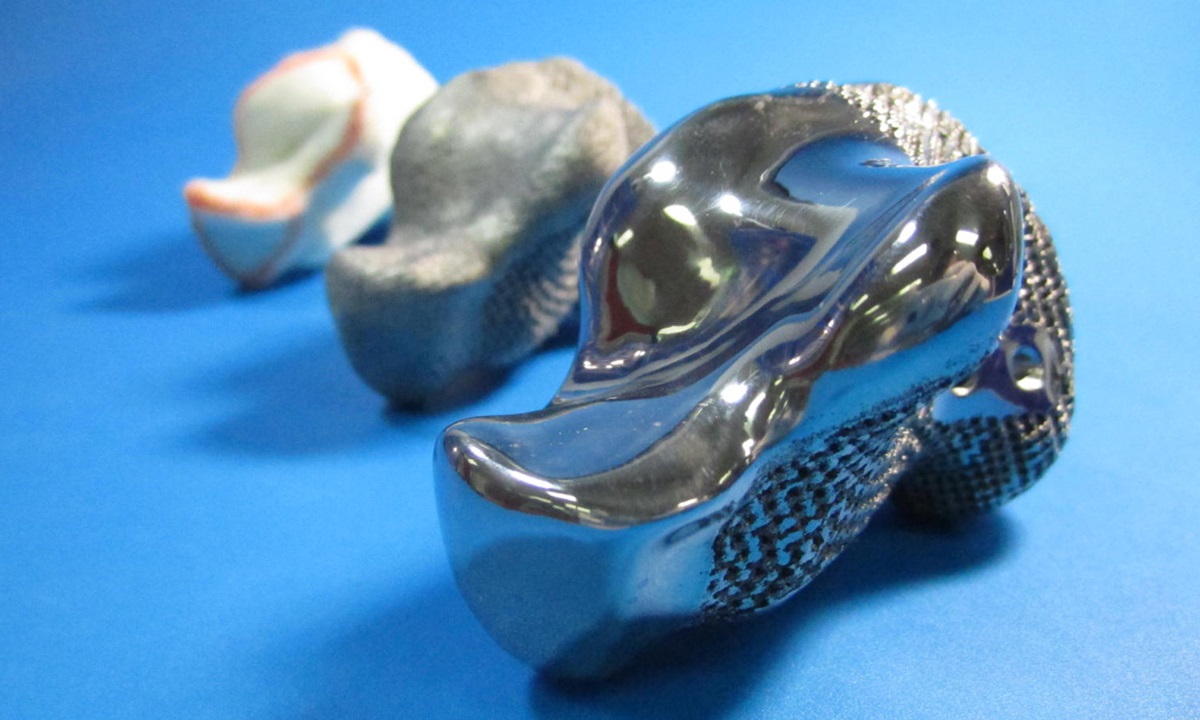 World-first surgery saves cancer patient's leg - CSIRO