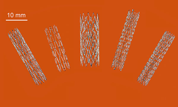 World first in 3D printing gives a personal touch to keep the blood ...