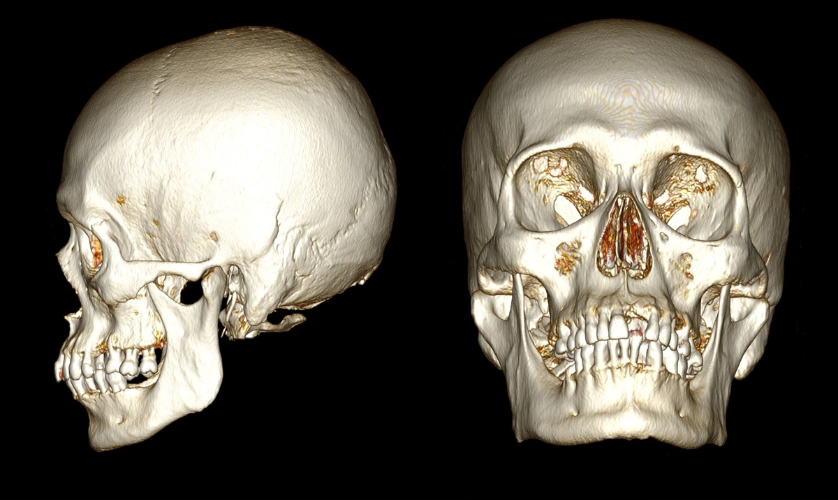 CSIRO develops AI tool for rapid identification in forensic ...